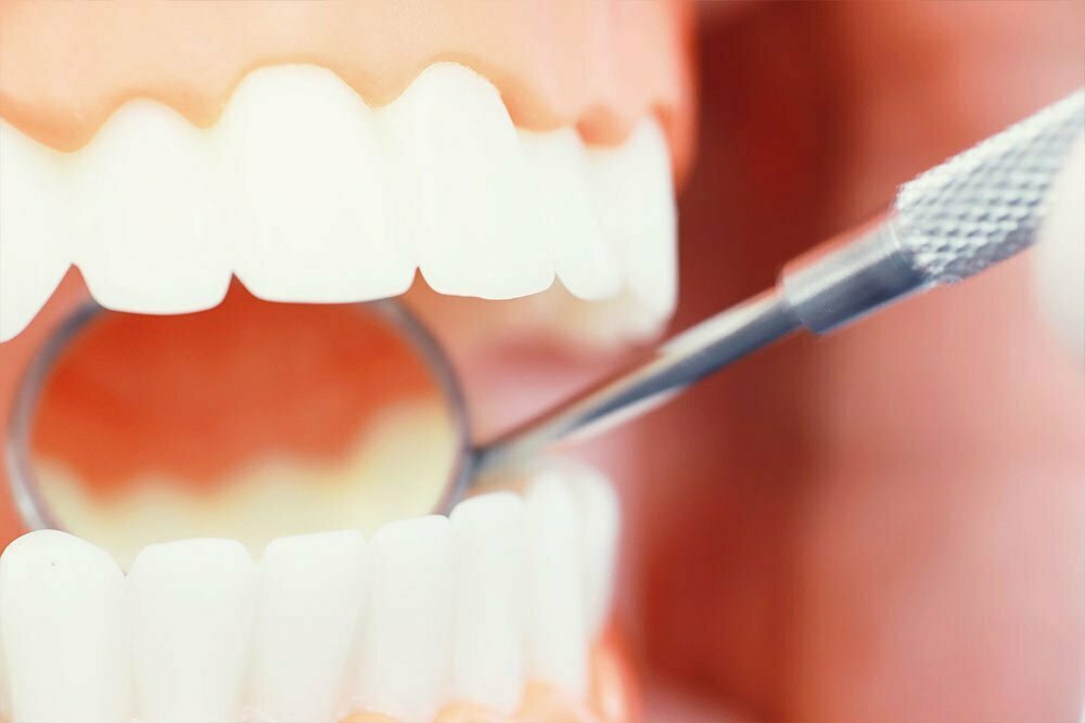 Bone Graft, Surgery - Queen Dental Centre